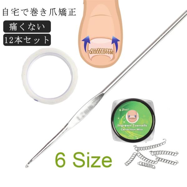 【セットの内容】矯正チエーン：2組セット（1組6本、共12本）　固定用テープ：1巻　つけ具：1本　【矯正チエーンのサイズ】12−15mm x 2本　14−17mm x 2本　16−20mm x 2本　18−22mm x 2本　20−24mm...