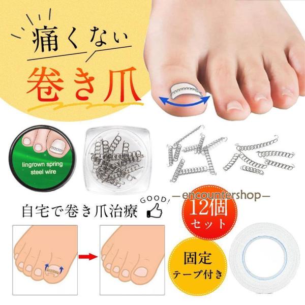 商品詳細:カラー:/画像通りサイズ:/F■商品説明セット内容:矯正チエーン2組セット（1組6個、共12個）サイズ:全6サイズ（1.2cm、1.6cm、 1.8cm 、2.0cm、2.4cm、2.6cm）・痛くない！自分でできる！・加工不要の...