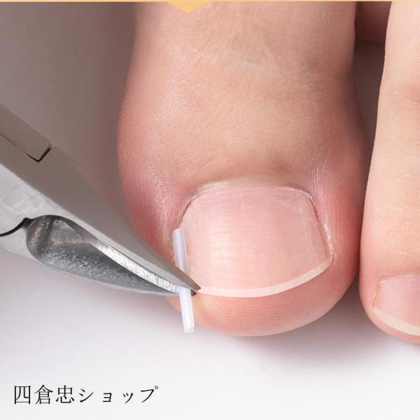 商品名: 巻き爪ケア 足 爪 ケア 巻爪 巻き爪ガード 60本セット やわらか クッション 痛み軽減 巻き爪グッズ 簡単 お手軽 ギフト                            商品説明:巻き爪をサポート 衛生的 目立ちにくい...