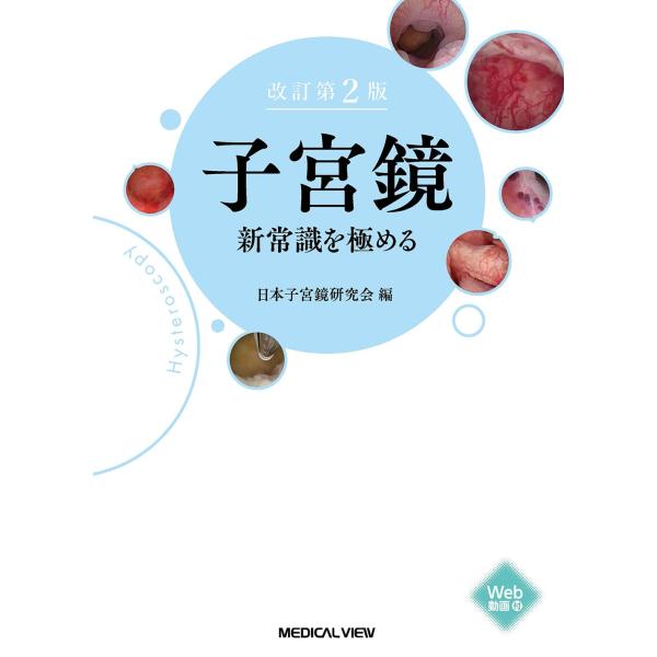 メジカルビュー社 【359】 技術指導が難しいといわれる子宮鏡。研究会編ならではの視野確保のtipsや術中の手の動きなどスタンダードな方法をしっかり示している。初心者，スキルアップを目指す術者に向け，新たなデバイスや機器の進歩も取り入れてア...