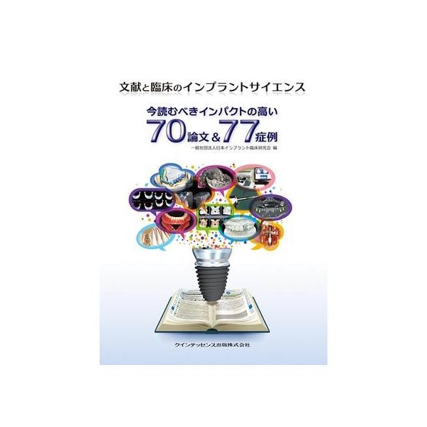 クインテッセンス出版 【0504】 インプラントに関する骨造成（Bone augmentation）、サイナスフロアエレベーション（Sinus augmentation）、即時埋入（Immediate implant placement）、...