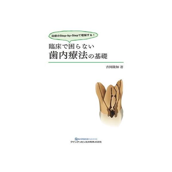 クインテッセンス出版 【0560】 2016年「ザ・クインテッセンス」の人気連載が一部加筆を経て待望の書籍化。新旧の世界的なエビデンスと近年大きく進化した器材を踏まえ、卒後、臨床の現場に出た際に「まず、これだけ知っていれば、エンドは困らずで...
