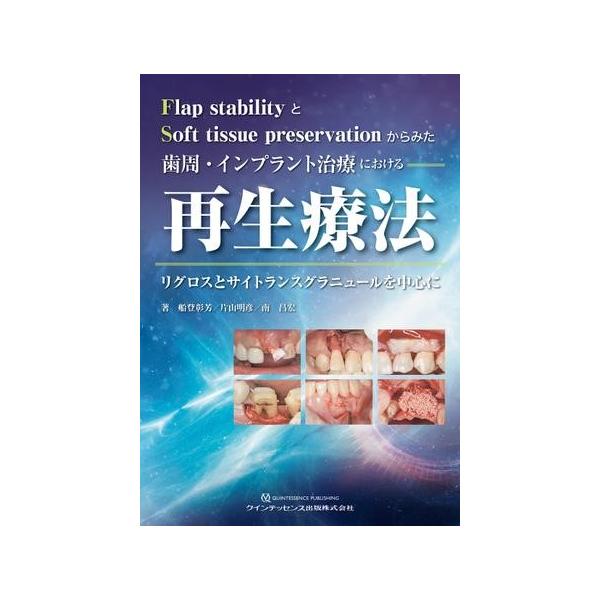 クインテッセンス出版 【0870】 歯周・インプラント治療における再生療法を成功に導くには、Flap stabilizationとSoft tissue stabilityを考慮した切開、フラップデザイン、縫合が重要な鍵を握っている。本書は...