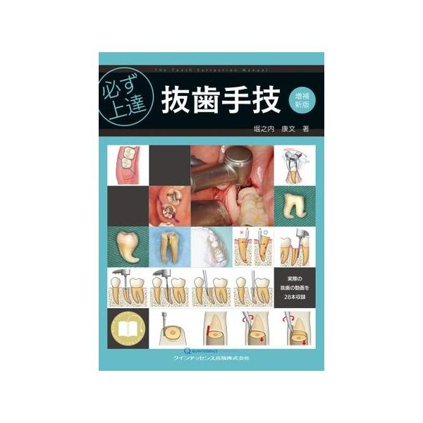 クインテッセンス出版 【0881】 抜歯に対する誤解・問題点を熟知した筆者が、若手歯科医師や抜歯が苦手な先生方が独習でマスターできるようにとの願いを込めて、たくさんの写真やイラストを用いて実践的なポイントやコツを示した解説書が大幅アップデー...