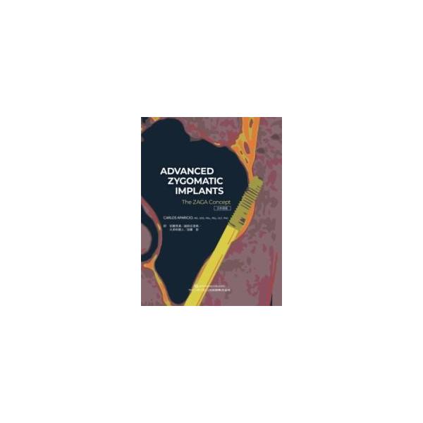クインテッセンス出版 【1149】 本書は、『ZYGOMATIC IMPLANTS The Anatomy-Guided Approach』の第二弾である『ADVANCED ZYGOMATIC IMPLANTS The ZAGA Conce...