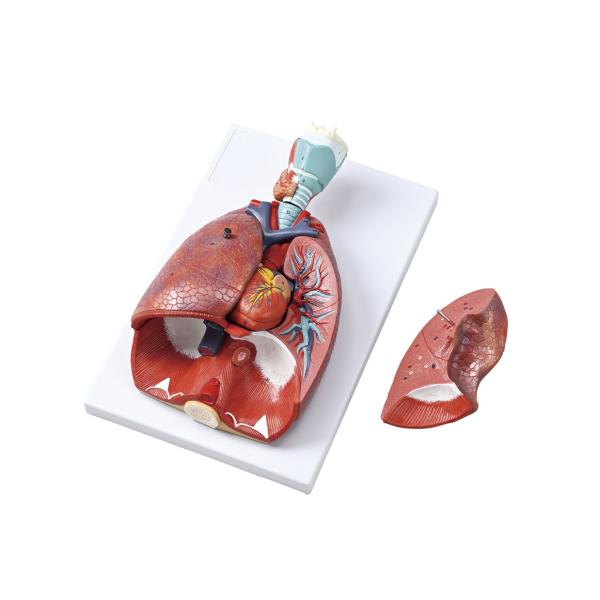 仕様材質: 樹脂製大きさ: 約260（W）×125（D）×400（H）mm・実物大。肺と主要静脈、動脈、喉頭、心臓、横隔膜から構成。・肺翼は取り外して2個1対となります。また喉頭と心臓も2分割可能。□発送までの手順１．ご注文をしていただきま...