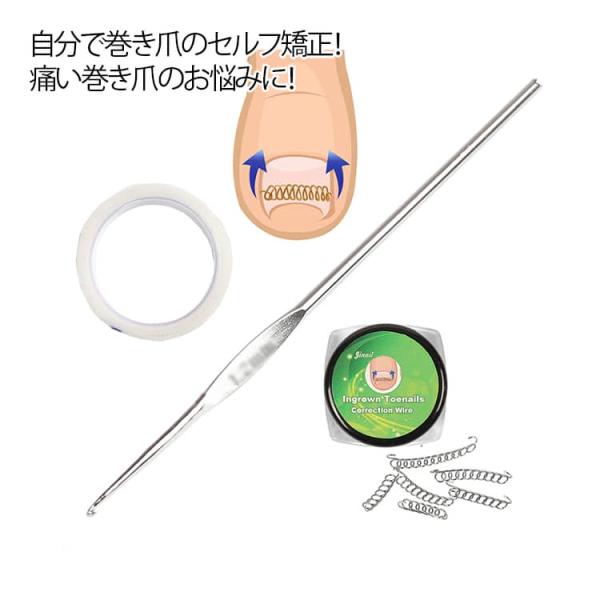 【セット内容】矯正チエーン：2組セット（1組6枚、共12枚） 固定用テープ：　1巻 つけ具：1本【矯正チエーンのサイズ】12−15mm×2本14−17mm×2本16−20mm×2本18−22mm×2本20−24mm×2本22−26mm×2本