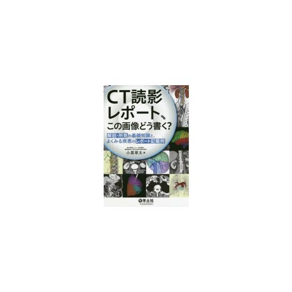 本 ISBN:9784758111911 小黒草太／著 出版社:羊土社 出版年月:2019年12月 サイズ:237P 21cm 医学 ≫ 臨床医学一般 [ 画像診断・超音波診断学 ] シ-テイ- ドクエイ レポ-ト コノ ガゾウ ドウ カク...