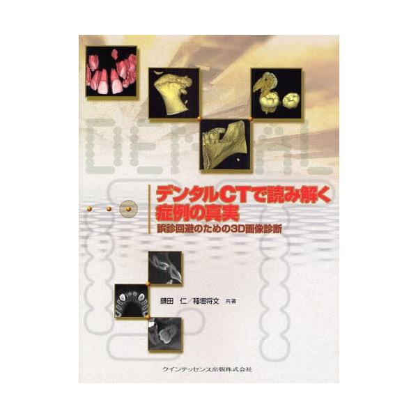 本 ISBN:9784781200415 鎌田仁／共著 稲垣将文／共著 出版社:クインテッセンス出版 出版年月:2008年11月 サイズ:91P 28cm 医学 ≫ 歯科学 [ 歯科学一般 ] デンタル シ-テイ- デ ヨミトク シヨウレイ...