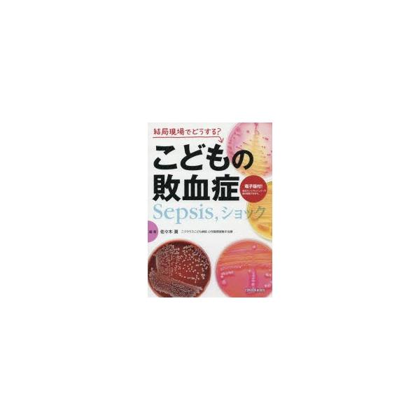 本 ISBN:9784784962471 佐々木潤／編著 出版社:日本医事新報社 出版年月:2019年03月 サイズ:169P 26cm 医学 ≫ 臨床医学内科系 [ 小児科学一般 ] ケツキヨク ゲンバ デ ドウスル コドモ ノ ハイケツ...