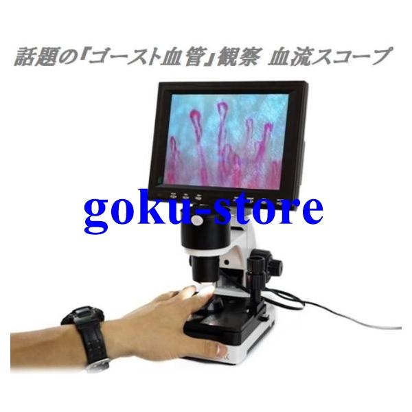 ・８インチモニターつきのオールインワンセット！安心の１年保証もついております。＜セット内容＞・モニター：8インチ液晶モニター・拡大倍率：380倍・内蔵：80,000ピクセル・出力：AV出力（お手持ちの大きなモニターへの映像出力も可能です）・...
