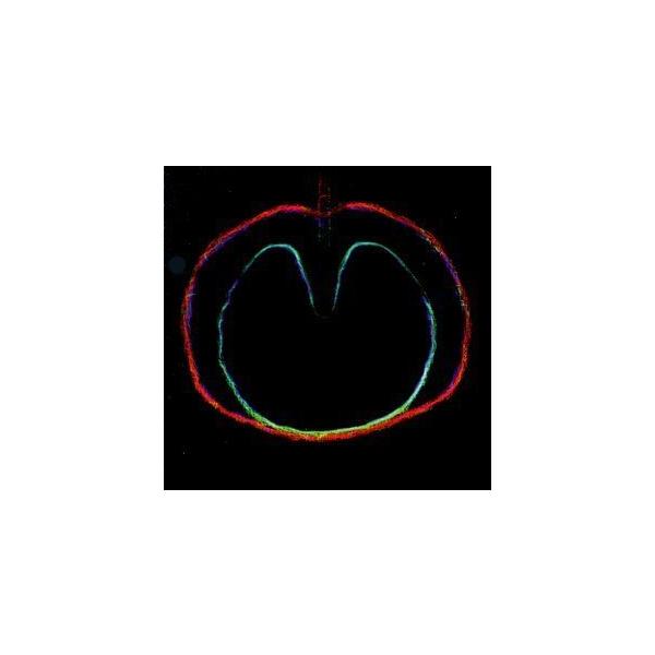 2015/7/7 発売ＵＫ盤レーベル：IMPORTS収録曲：(エックスティーシー)