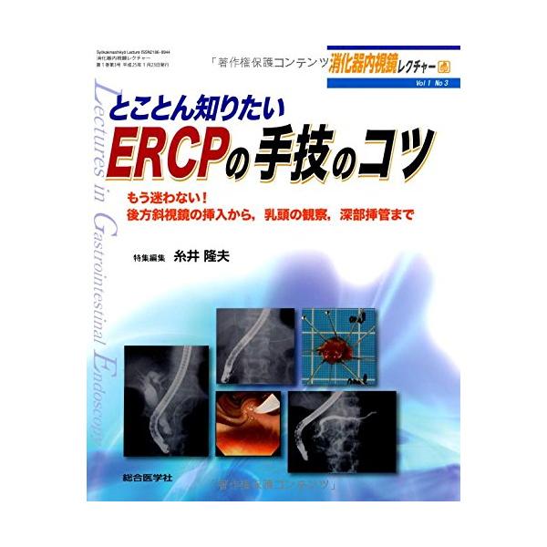 （中古品）消化器内視鏡レクチャ- (l‐3) (消化器内視鏡レクチャー Vol 1-3)商品写真はサンプル写真となっております。写真の商品が届くわけでは御座いません。用途機能として最低限の付属品はお送りいたしますが取扱説明書、リモコン等含ま...