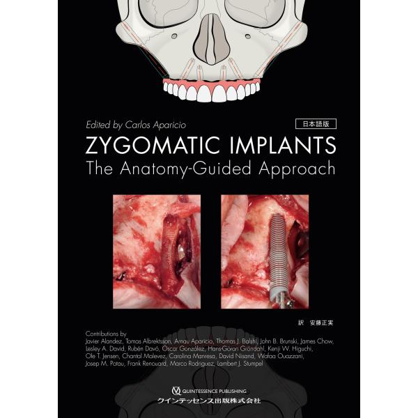 （中古品）ZYGOMATIC IMPLANTS 日本語版: The Anatomy-Guided Approach商品写真はサンプル写真となっております。写真の商品が届くわけでは御座いません。用途機能として最低限の付属品はお送りいたしますが...