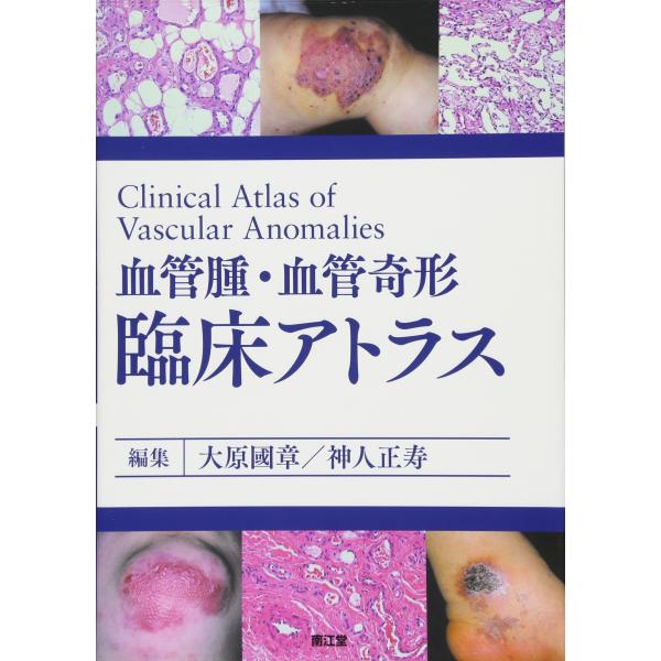 （中古品）血管腫・血管奇形 臨床アトラス商品写真はサンプル写真となっております。写真の商品が届くわけでは御座いません。※通常の中古品のほか、メーカーにて動作点検・調整された「整備済み品」でお届けする場合がございます。用途機能として最低限の付...