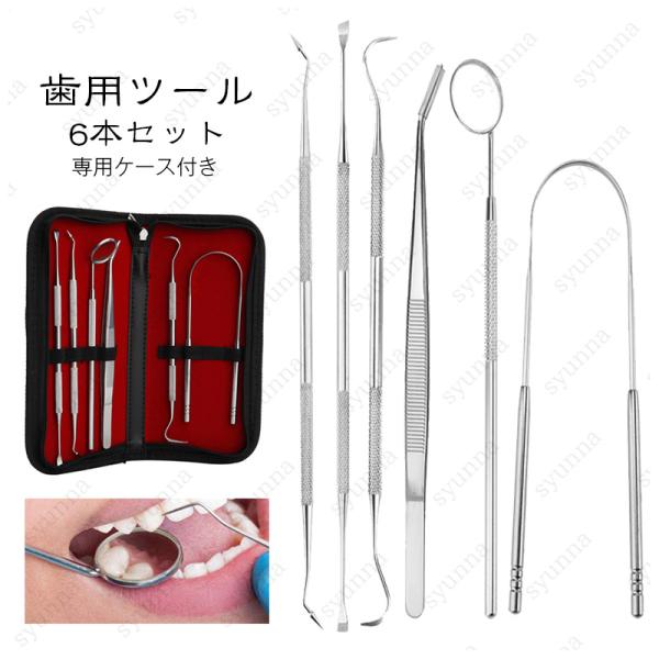 【商品説明】歯石や汚れを簡単チェック＆ケア！最適なプロ仕様のツール　6本セットです。手軽に 本格デンタルケアができます。持ち運びにも便利な専用ケース付きです。きっちり収まるので、安全かつ清潔に収納することができます。【セット内容】・鎌型aス...