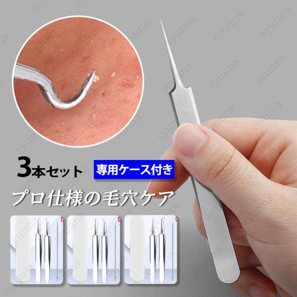 ★ご覧頂き有難うございます。■【商品説明】●ステンレス製の先端が極細のマイクロピンセット2本セットです。■【商品特徴a】●精密機器や電子部品の取扱いだけでなく、ラインストーン、つけまつ毛の取扱いなど●細かな作業に不可欠なプロ仕様のピンセット...