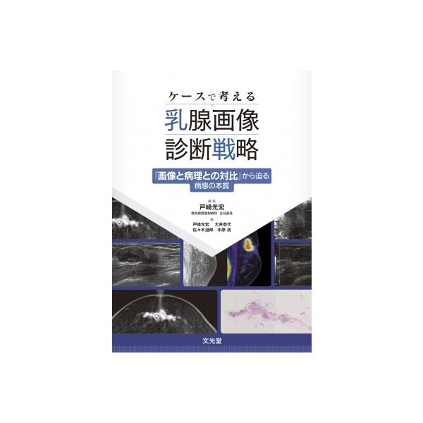発売日:2021年11月 / ジャンル:物理・科学・医学 / フォーマット:本 / 出版社:文光堂 / 発売国:日本 / ISBN:9784830637636 / アーティストキーワード:戸崎光宏 内容詳細:目次:第１章　病理診断別の総合画...
