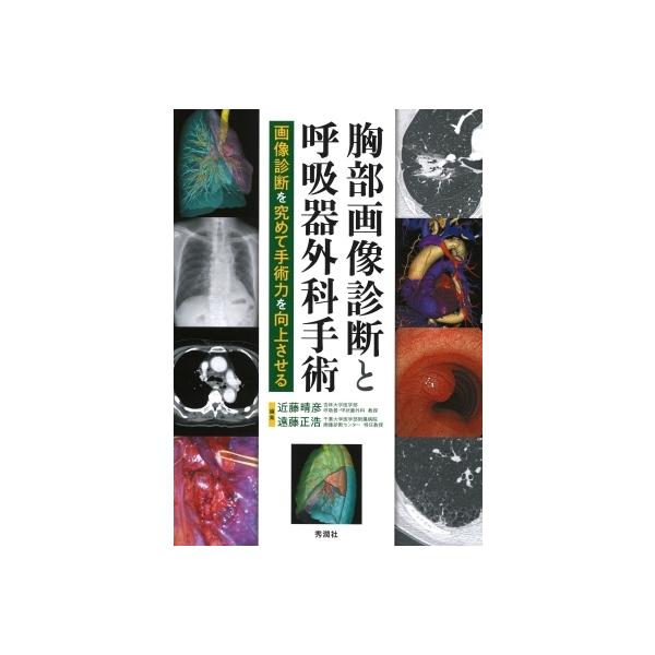 発売日:2022年03月 / ジャンル:物理・科学・医学 / フォーマット:本 / 出版社:学研メディカル秀潤社 / 発売国:日本 / ISBN:9784780904420 / アーティストキーワード:近藤晴彦 内容詳細:画像診断を駆使する...