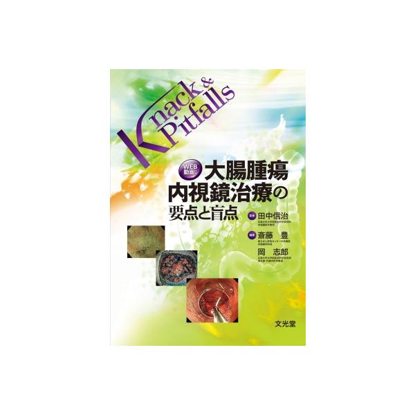 発売日:2022年10月 / ジャンル:物理・科学・医学 / フォーマット:本 / 出版社:文光堂 / 発売国:日本 / ISBN:9784830621147 / アーティストキーワード:田中信治 内容詳細:目次:１章　大腸腫瘍に対する内視...