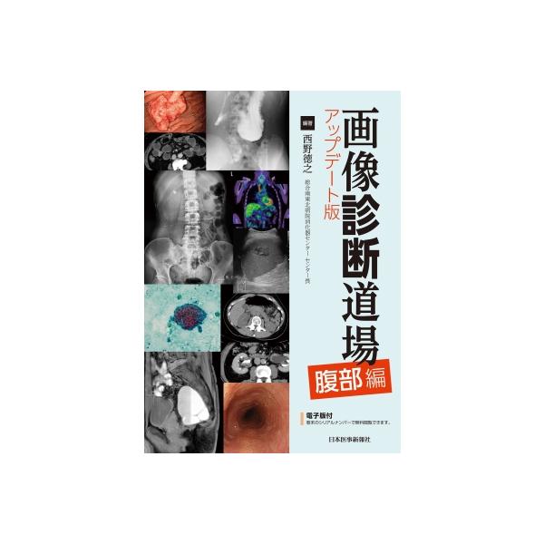 発売日:2023年02月 / ジャンル:物理・科学・医学 / フォーマット:本 / 出版社:日本医事新報社 / 発売国:日本 / ISBN:9784784924172 / アーティストキーワード:西野徳之 内容詳細:目次:逆流性食道炎の悪化...