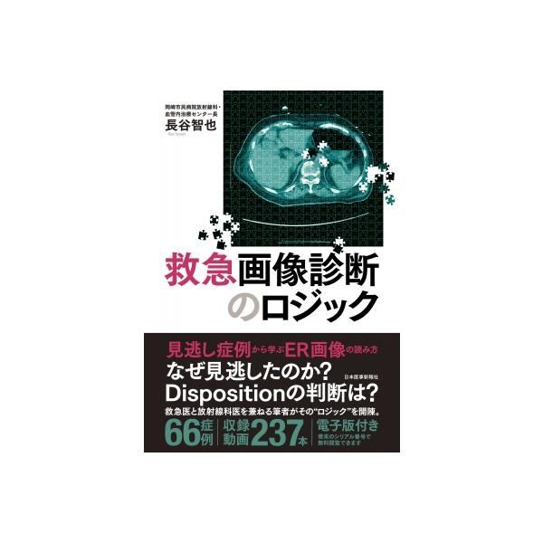 発売日:2023年07月 / ジャンル:物理・科学・医学 / フォーマット:本 / 出版社:日本医事新報社 / 発売国:日本 / ISBN:9784784924004 / アーティストキーワード:長谷智也 内容詳細:見逃し症例から学ぶＥＲ画...