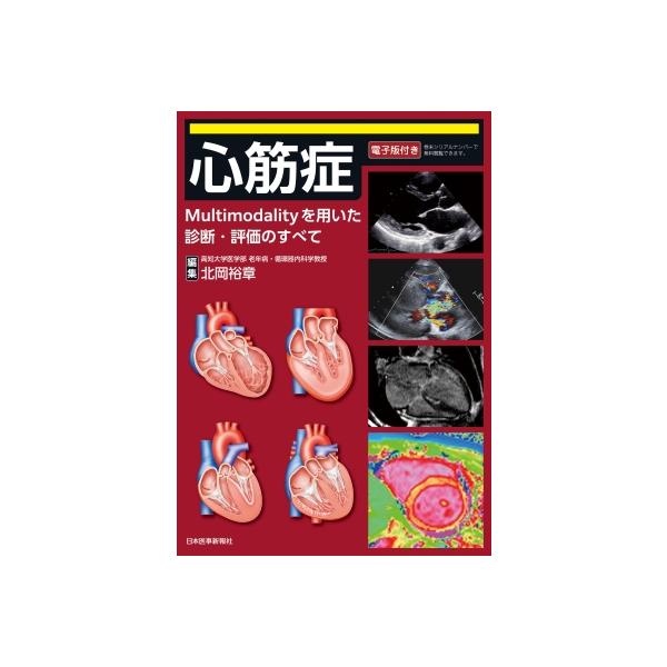 発売日:2024年01月 / ジャンル:物理・科学・医学 / フォーマット:本 / 出版社:日本医事新報社 / 発売国:日本 / ISBN:9784784903696 / アーティストキーワード:北岡裕章 内容詳細:目次:１章　心筋症の定義...
