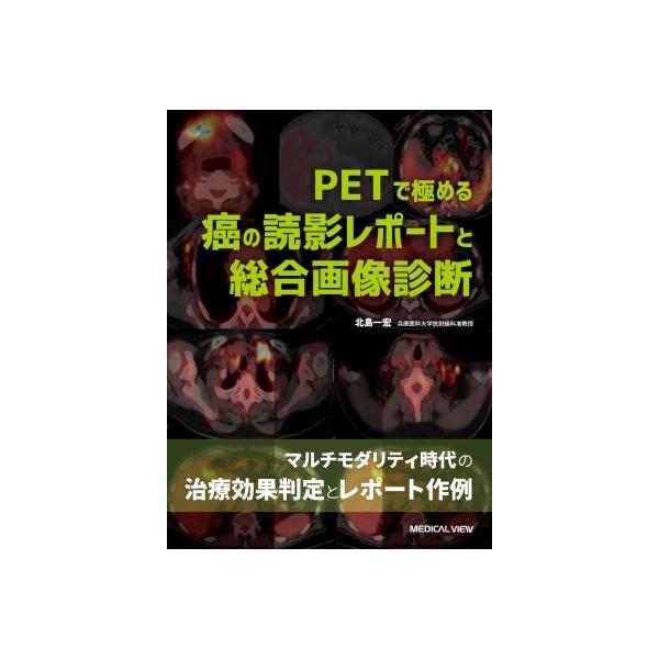 発売日:2024年02月 / ジャンル:物理・科学・医学 / フォーマット:本 / 出版社:メジカルビュー社 / 発売国:日本 / ISBN:9784758321181 / アーティストキーワード:北島一宏 内容詳細:CT/MRI/PET ...