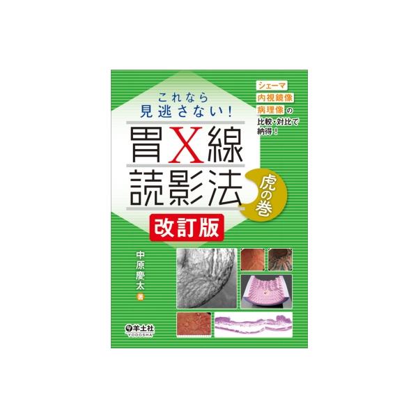 発売日:2025年10月 / ジャンル:物理・科学・医学 / フォーマット:本 / 出版社:羊土社 / 発売国:日本 / ISBN:9784758110860 / アーティストキーワード:中原慶太 内容詳細:胃X線の読み方の定番書が大改訂！...