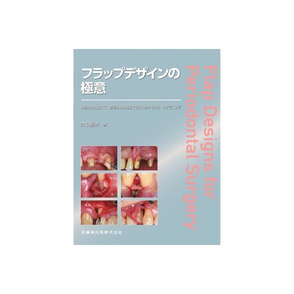 発売日:2026年03月 / ジャンル:物理・科学・医学 / フォーマット:本 / 出版社:医歯薬出版 / 発売国:日本 / ISBN:9784263447642 / アーティストキーワード:奈良嘉峰 内容詳細:歯周外科を成功させるための、...