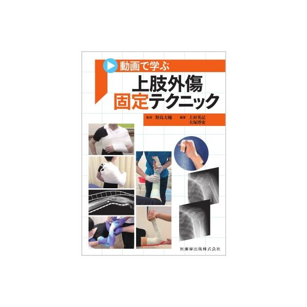 発売日:2026年07月 / ジャンル:物理・科学・医学 / フォーマット:本 / 出版社:医歯薬出版 / 発売国:日本 / ISBN:9784263241165 / アーティストキーワード:野島大輔 内容詳細:運動器疾患に必要な固定法を、...