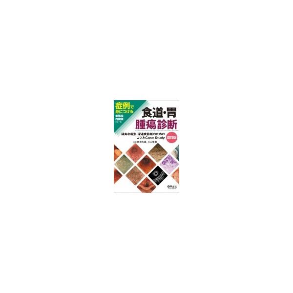 発売日:2015年05月 / ジャンル:物理・科学・医学 / フォーマット:本 / 出版社:羊土社 / 発売国:日本 / ISBN:9784758110563 / アーティストキーワード:田尻久雄 内容詳細:目次:第１章　解剖と内視鏡挿入法...