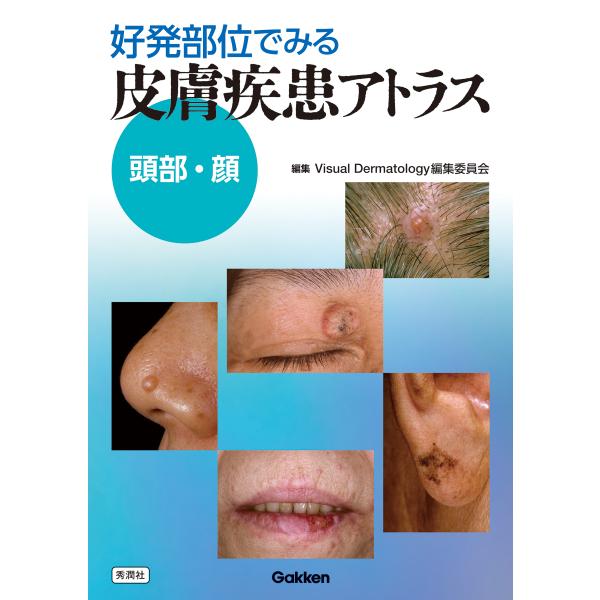 出版社名：Ｇａｋｋｅｎ著者名：Ｖｉｓｕａｌ　Ｄｅｒｍａｔｏｌｏｇｙ編集委員会発行年月：2025年01月キーワード：コウハツ ブイ デ ミル ヒフ シッカン アトラス トウブ カオ、ヴィジュアル ダーマトロジー ヘンシュウ イインカイ