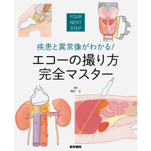 出版社名：医学書院著者名：種村正発行年月：2015年05月キーワード：シッカン ト イジョウゾウ ガ ワカル エコー ノ トリカタ カンゼン マスター、タネムラ,タダシ