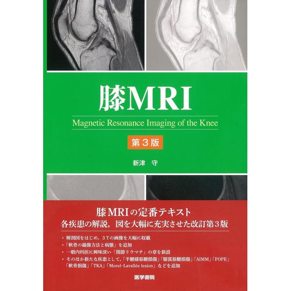 出版社名：医学書院著者名：新津守発行年月：2018年07月版：第３版キーワード：ヒザ エムアールアイ*ヒザ MRI*MAGNETIC RESONANCE IMAGING OF THE KNEE、ニイツ,マモル