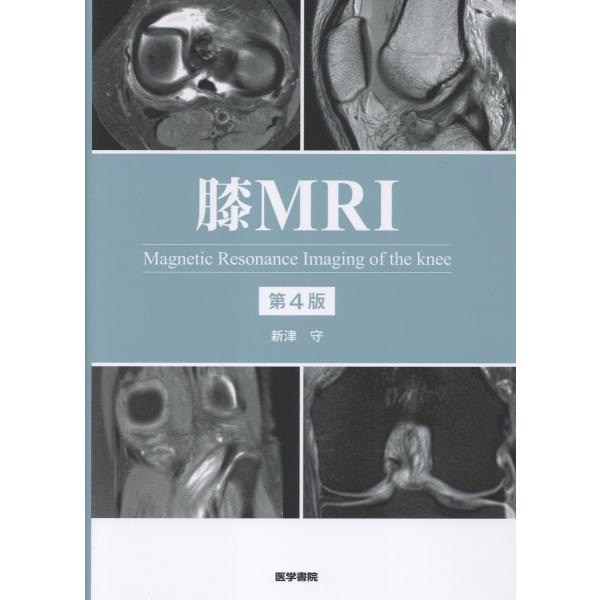 出版社名：医学書院著者名：新津守発行年月：2026年04月版：第４版キーワード：ヒザ エムアールアイ*ヒザ MRI*MAGNETIC RESONANCE IMAGING OF THE KNEE、ニイツ,マモル