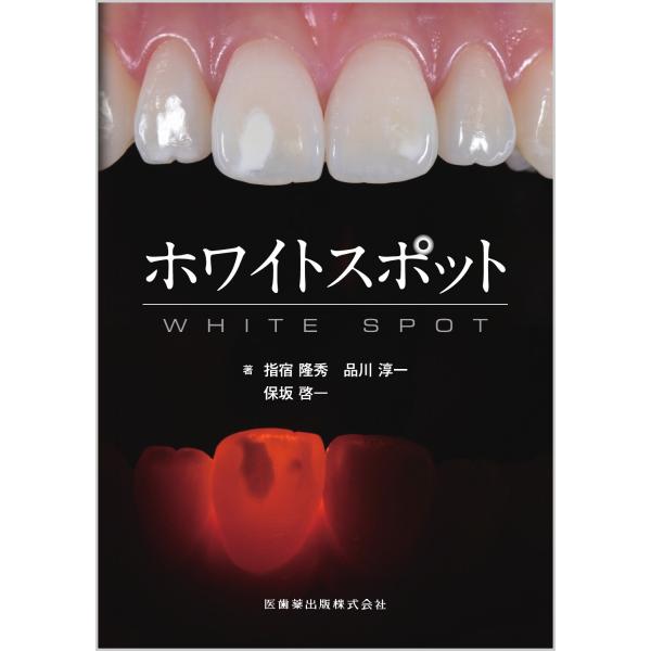 出版社名：医歯薬出版著者名：指宿隆秀、品川淳一、保坂啓一発行年月：2026年02月キーワード：ホワイト スポット、イブスキ,タカヒデ、シナガワ,ジュンイチ、ホサカ,ケイイチ