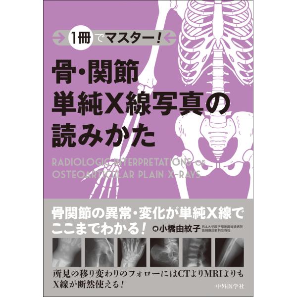 出版社名：中外医学社著者名：小橋由紋子発行年月：2024年02月キーワード：イッサツ デ マスター コツ カンセツ タンジュン エックスセン ノ ヨミカタ、コバシ,ユウコ