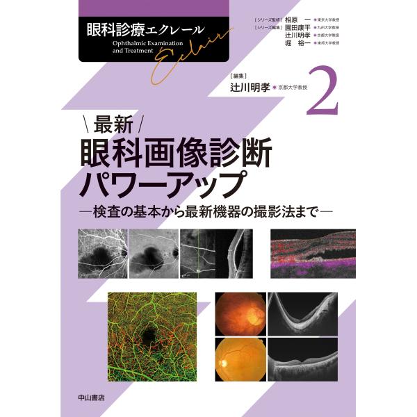 出版社名：中山書店著者名：辻川明孝シリーズ名：眼科診療エクレール発行年月：2023年10月キーワード：サイシン ガンカ ガゾウ シンダン パワー アップ、ツジカワ,アキタカ
