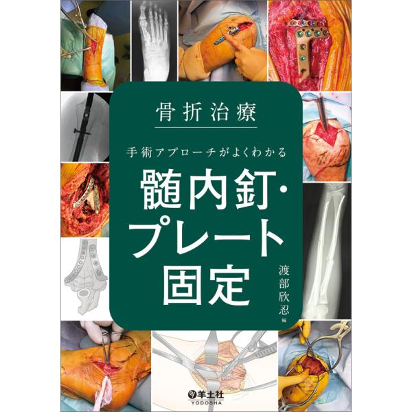 出版社名：羊土社著者名：渡部欣忍発行年月：2024年03月キーワード：コッセツ チリョウ シュジュツ アプローチ ガ ヨク ワカル ズイナイテイ プレート コテイ、ワタナベ,ヨシノブ