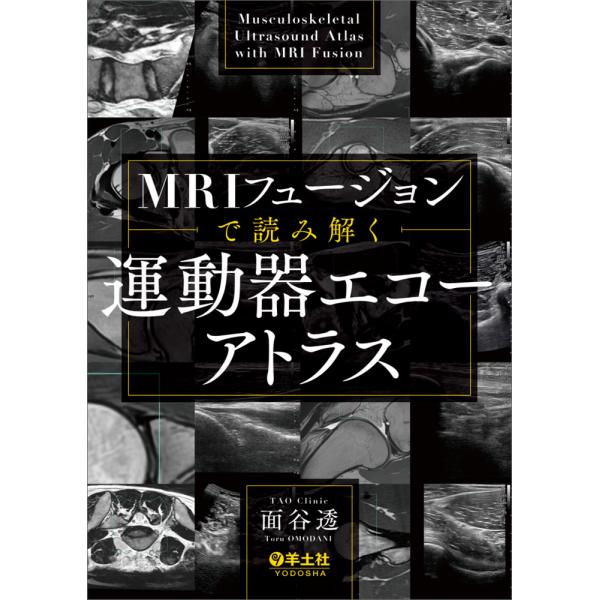 出版社名：羊土社著者名：面谷透発行年月：2026年06月キーワード：エムアールアイ フュージョン デ ヨミトク ウンドウキ エコー アトラス、オモダニ,トオル