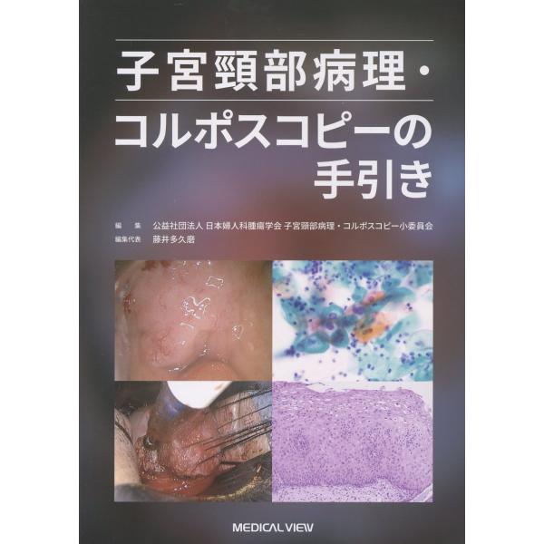出版社名：メジカルビュー社著者名：日本婦人科腫瘍学会、子宮頸部病理・コルポスコピー小委員会、藤井多久磨発行年月：2026年05月キーワード：シキュウ ケイブ ビョウリ コルポスコピー ノ テビキ、ニホン フジンカ シュヨウ ガッカイ、シキュ...