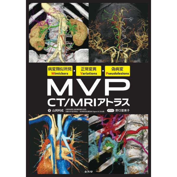 出版社名：金芳堂著者名：山岡利成発行年月：2026年04月キーワード：ビョウヘン ルイジ ショケン ミミッカーズ セイジョウ ヘンイ バリエーションズ ギビョウヘン シュードリージョンズ エムブイピー シーティー エムアールアイ アトラス、...