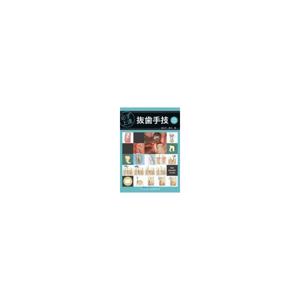 出版社名：クインテッセンス出版著者名：堀之内康文シリーズ名：必ず上達シリーズ発行年月：2022年06月版：増補新版キーワード：カナラズ ジョウタツ バッシ シュギ、ホリノウチ,ヤスフミ