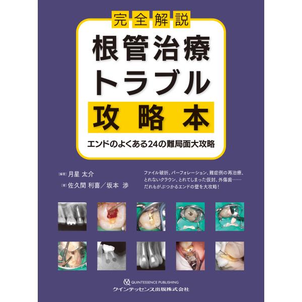出版社名：クインテッセンス出版著者名：月星太介、佐久間利喜、坂本渉発行年月：2025年09月キーワード：カンゼン カイセツ コンカン チリョウ トラブル コウリャクボン、ツキボシ,タイスケ、サクマ,トシキ、サカモト,ショウ