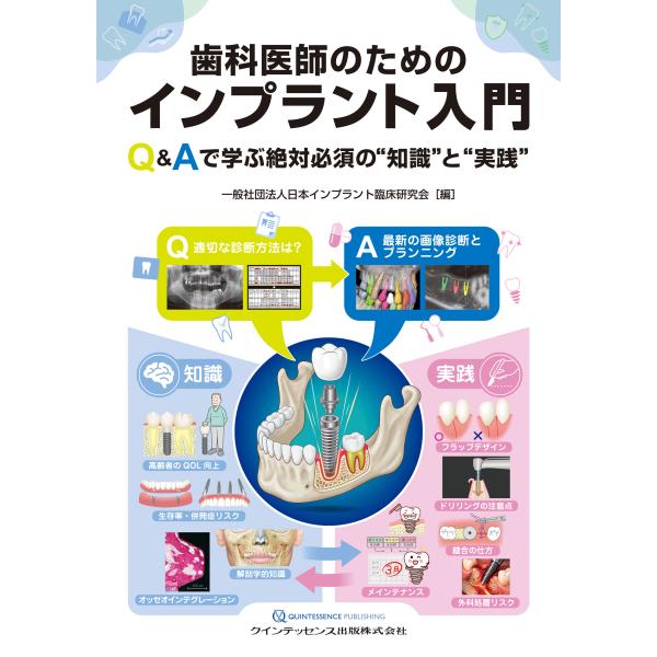 出版社名：クインテッセンス出版著者名：日本インプラント臨床研究会、笹谷和伸、若井広明発行年月：2026年07月キーワード：シカイシ ノ タメノ インプラント ニュウモン、ニホン インプラント リンショウ ケンキュウカイ、ササヤ,カズノブ、ワ...