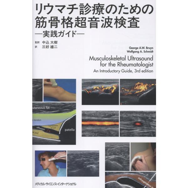 出版社名：メディカル・サイエンス・インターナショナル著者名：中込大樹、三好雄二発行年月：2026年04月キーワード：リウマチ シンリョウ ノ タメノ キンコッカク チョウオンパ ケンサ ジッセン ガイド、ナカゴミ,ダイキ、ミヨシ,ユウジ