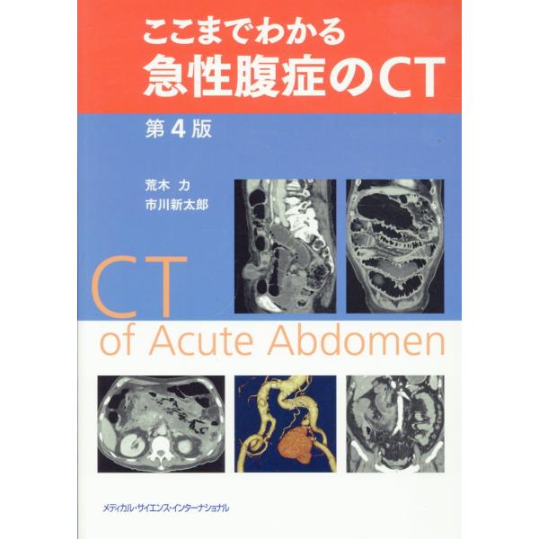 出版社名：メディカル・サイエンス・インターナショナル著者名：荒木力、市川新太郎発行年月：2026年09月版：第４版キーワード：ココマデ ワカル キュウセイ フクショウ ノ シーティー*ココマデ ワカル キュウセイ フクショウ ノ CT、アラ...