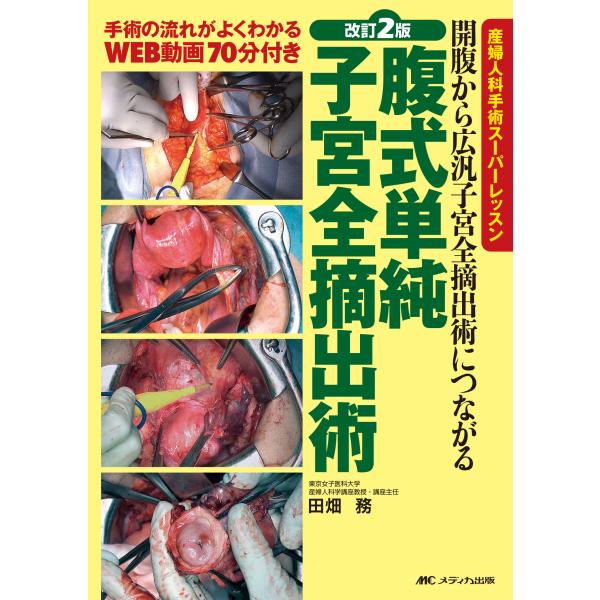 出版社名：メディカ出版著者名：田畑務シリーズ名：産婦人科手術スーパーレッスン発行年月：2025年06月版：改訂２版キーワード：フクシキ タンジュン シキュウ ゼンテキシュツジュツ、タバタ,ツトム