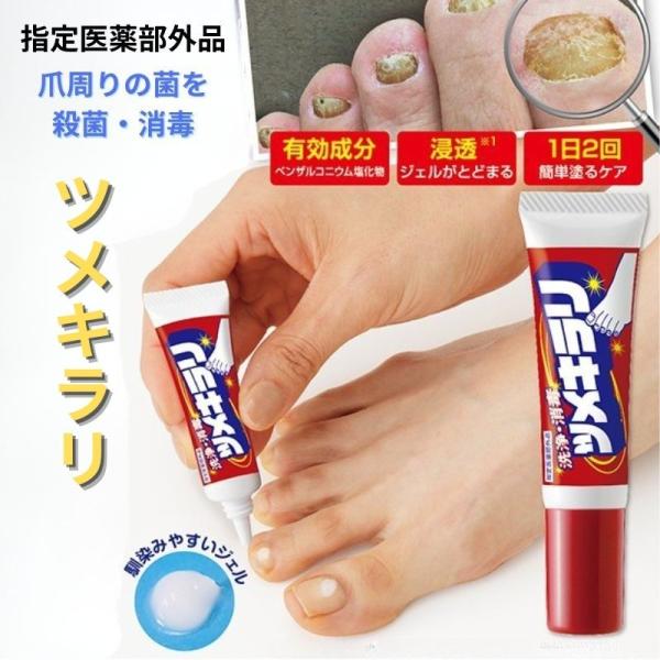 ※こちらの商品はメール便発送となりポスト投函配達となります　手渡し配達ではございません※爪の中の菌まで殺菌・消毒。製薬会社が作った薬用ジェル。ジェル状だからしっかりとどまり、爪の中までぐんぐん浸透。指定医薬部外品の有効効果が原因菌にダイレク...